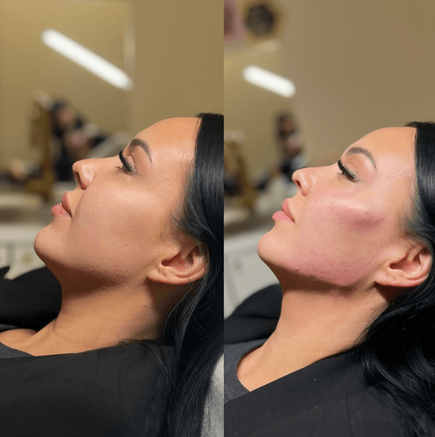 Lina Aesthetics | Professional Luxury Beauty Treatments